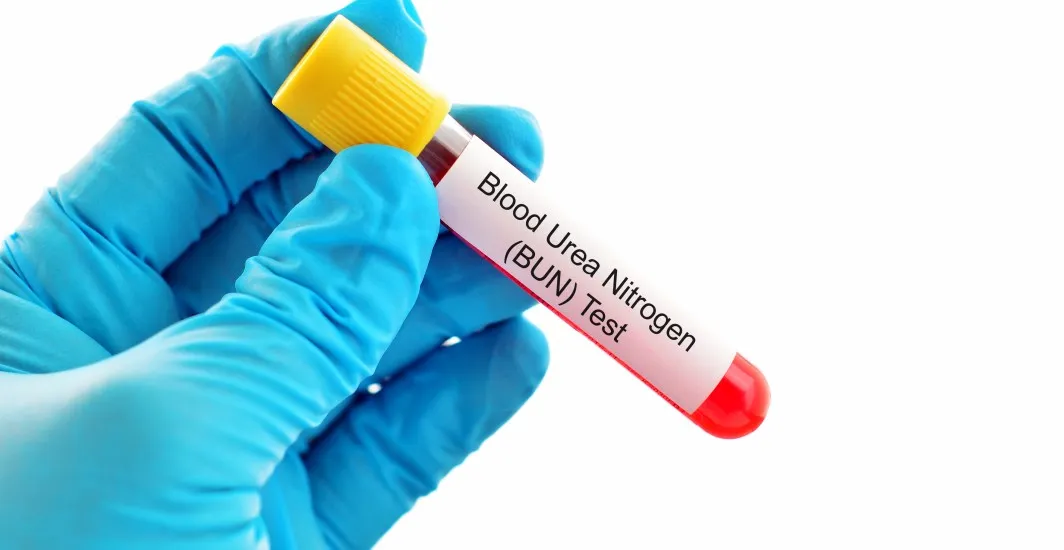 What Is the BUN Test? A Complete Beginner's Guide to Kidney Health